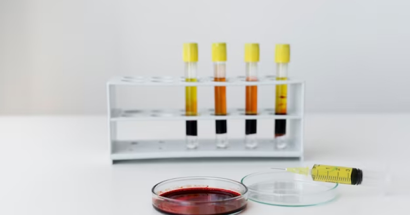 How Long Does Pre-employment Drug Screening Take - We Test